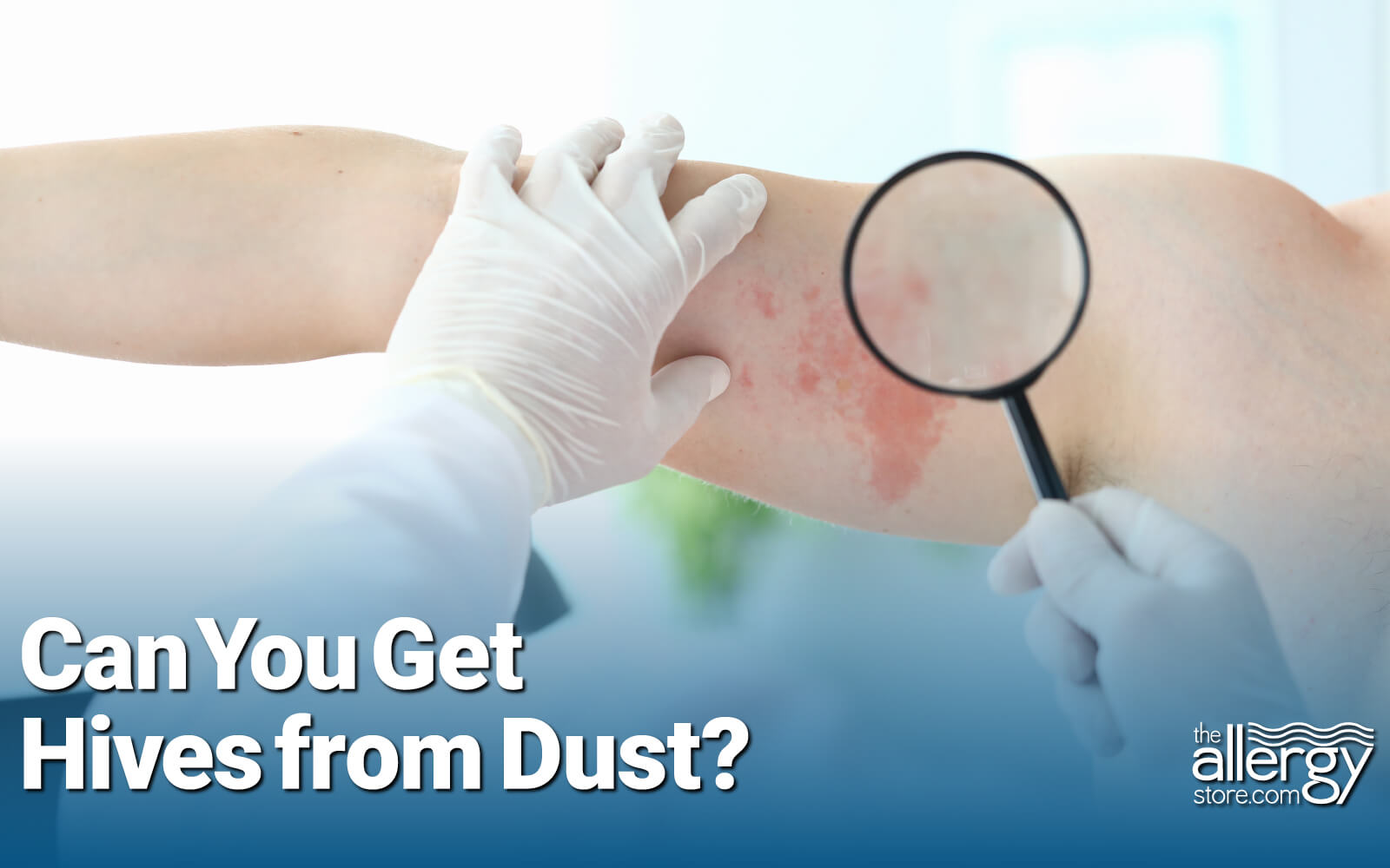 Can You Get Hives from Dust? | The Cause of Hives Can be Elusive